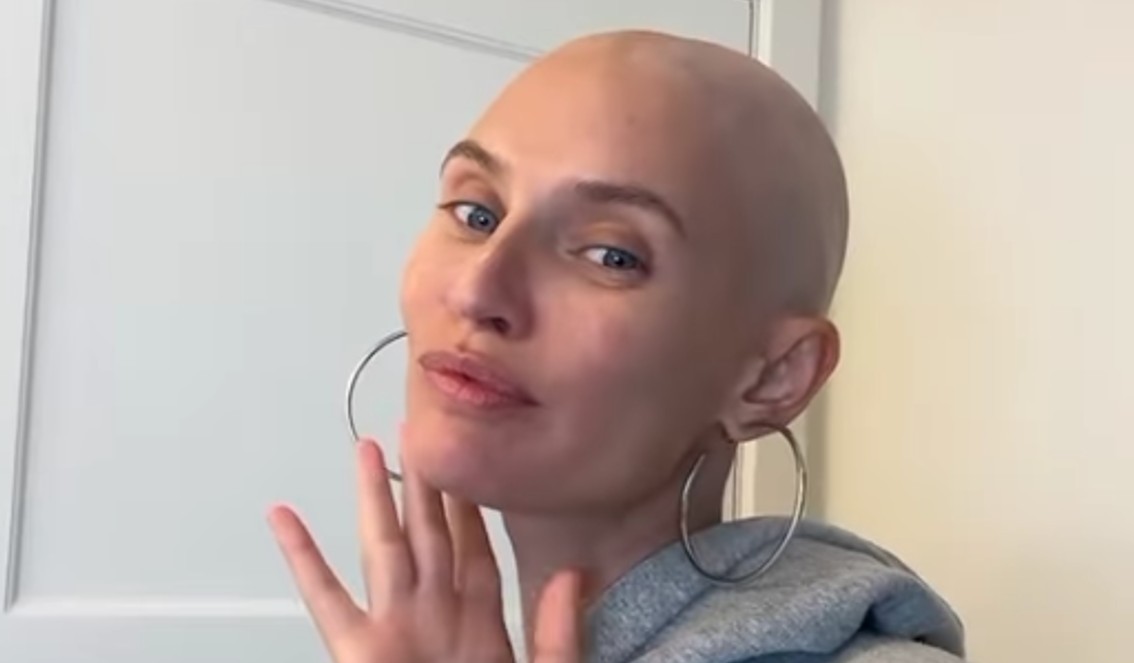 ''Con cicatrice sullo stomaco e senza capelli, non incarno lo ...