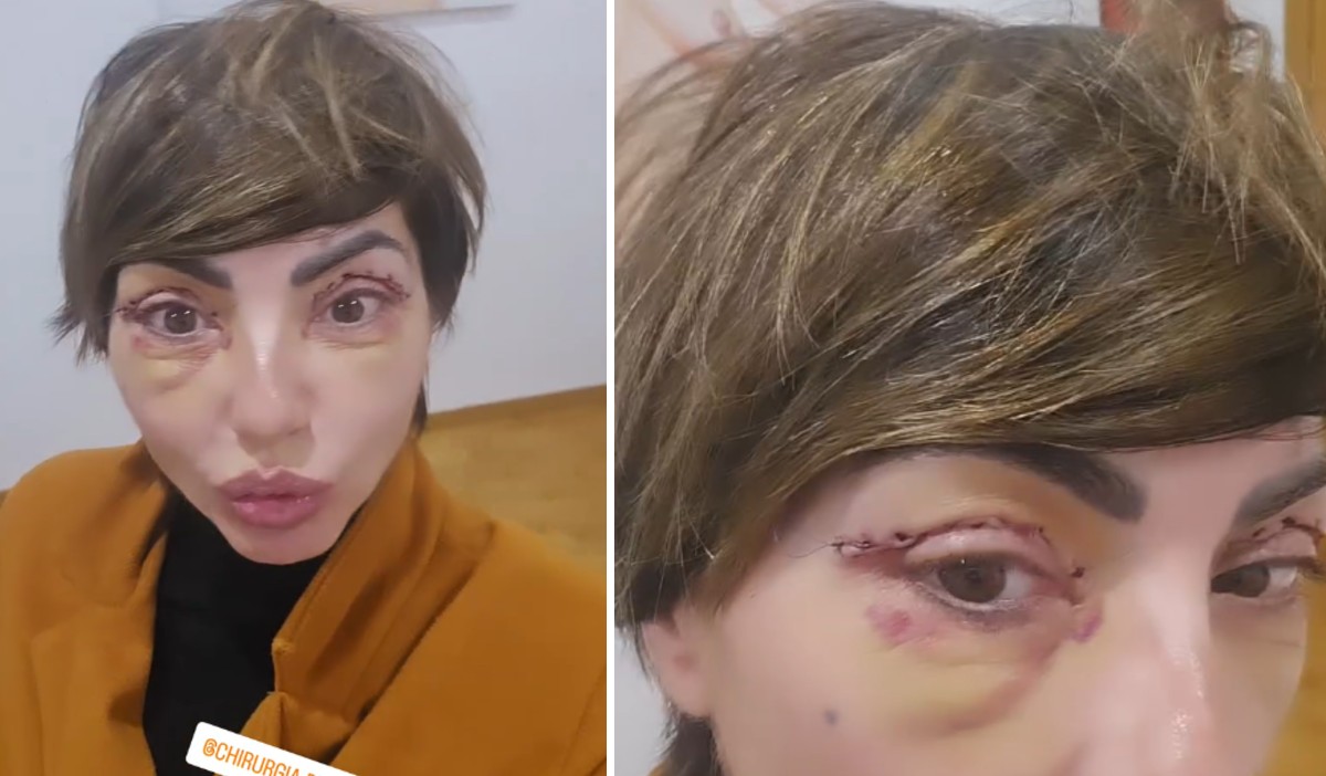 ''Ho tolto i punti'': l’ex Non è la Rai Ilaria Galassi si è sottoposta ...