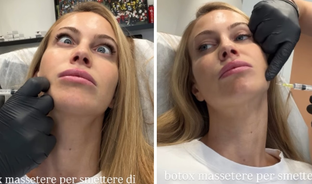 ''18.30 vengo a farmi il Botox'': Taylor Mega va dal chirurgo estetico ...