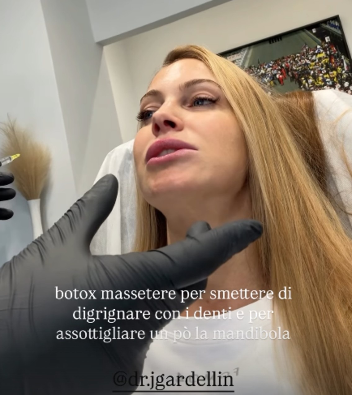 ''18.30 vengo a farmi il Botox'': Taylor Mega va dal chirurgo estetico ...