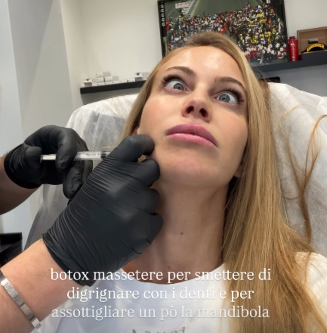 ''18.30 vengo a farmi il Botox'': Taylor Mega va dal chirurgo estetico ...