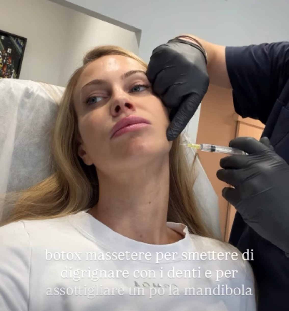 ''18.30 vengo a farmi il Botox'': Taylor Mega va dal chirurgo estetico ...